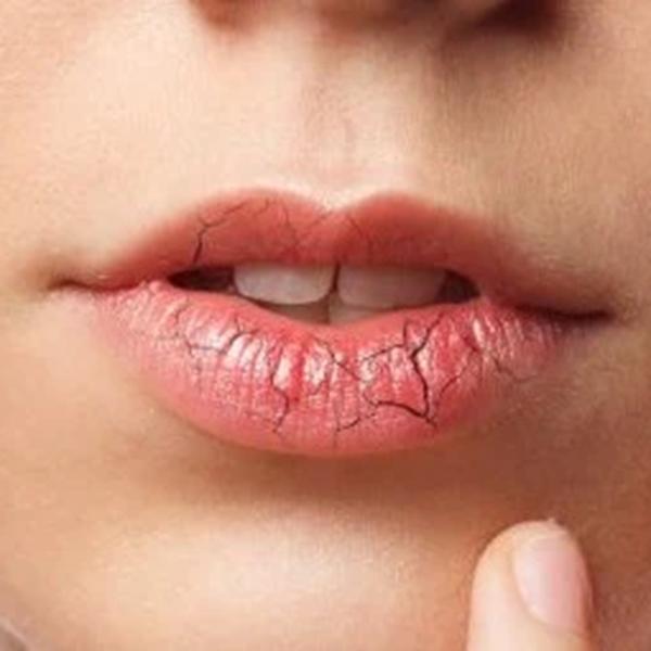 LABBRA – ERBORISTERIA L'ANGOLO VERDE